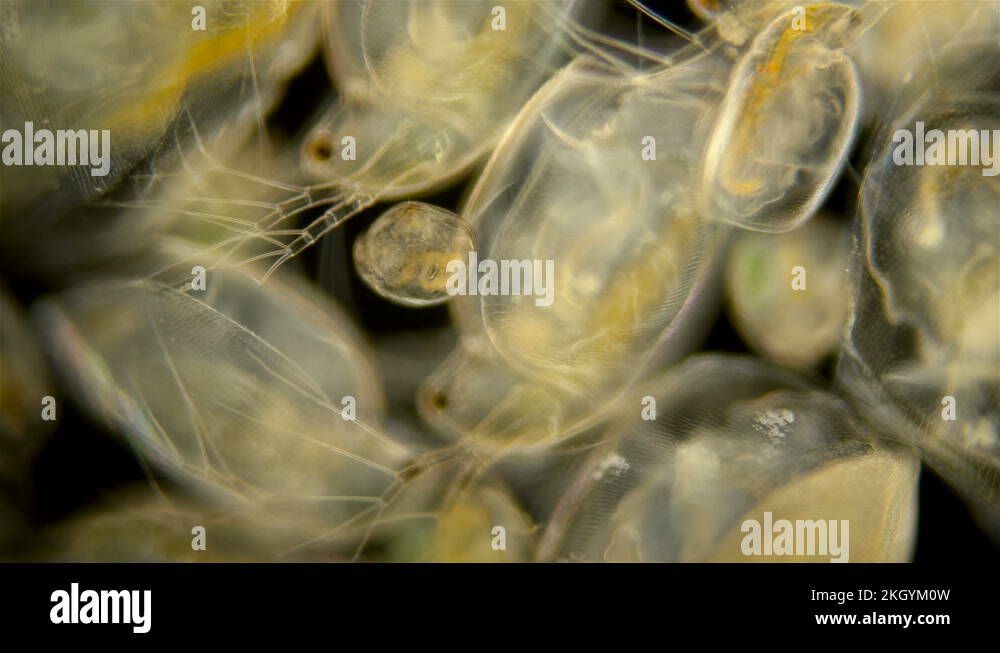 Zooplankton under the microscope. A colony of different plankton ...