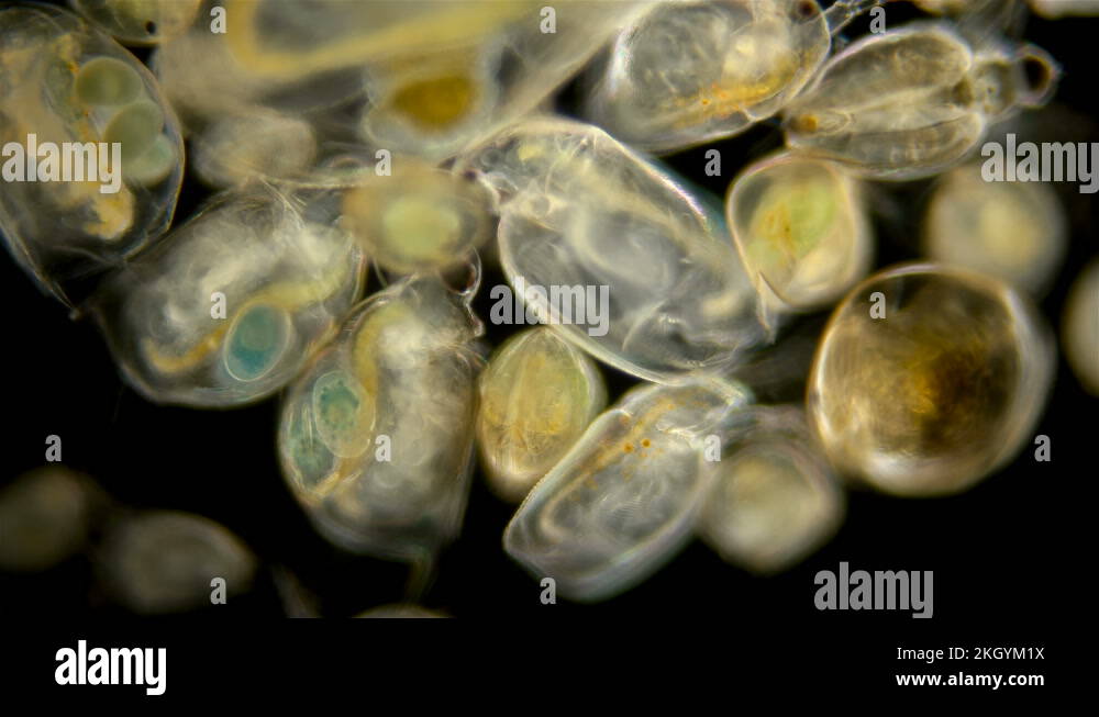 Zooplankton under the microscope. A colony of different plankton ...