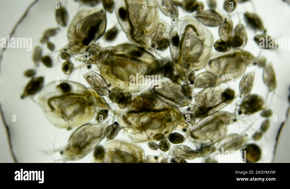Zooplankton under the microscope. A colony of different plankton ...