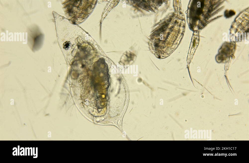 Zooplankton under the microscope Stock Video Footage - Alamy