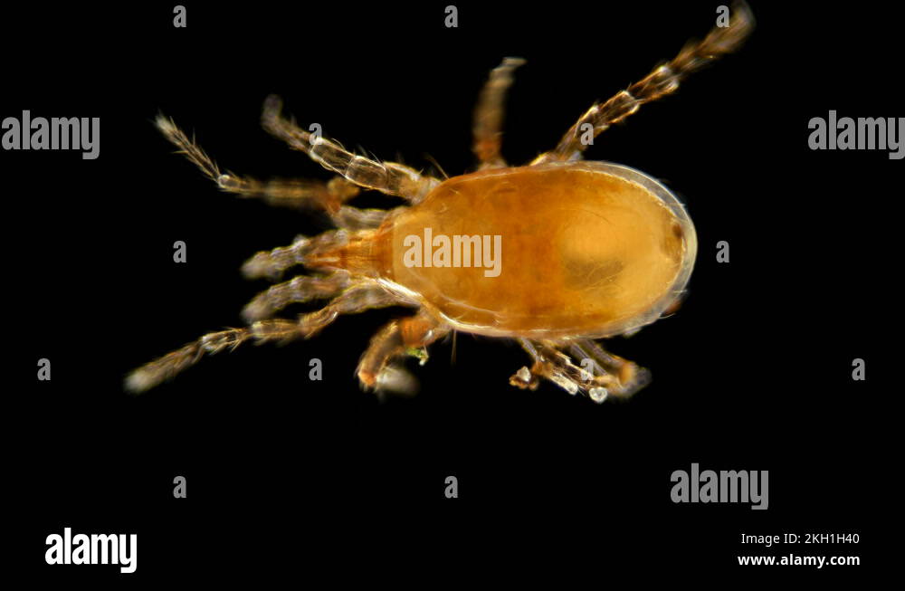 tick under the microscope, from the order Mesostigmata Stock Video ...