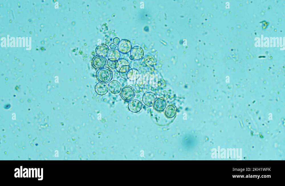 Tissue sample Stock Videos & Footage - HD and 4K Video Clips - Alamy