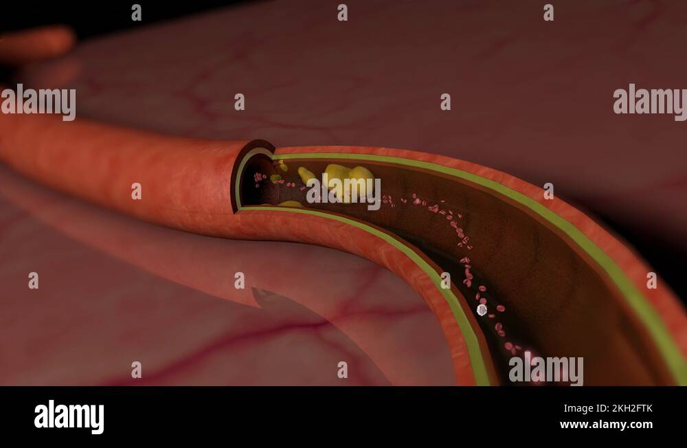 Artery art Stock Videos & Footage - HD and 4K Video Clips - Alamy