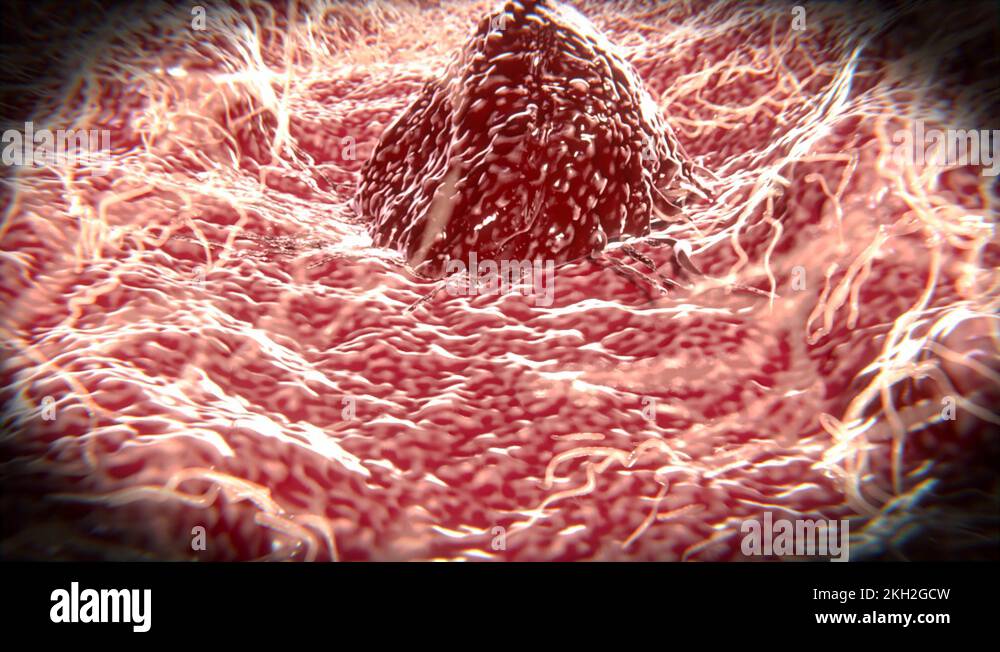 Migrating cancer cell, animation Stock Video Footage - Alamy