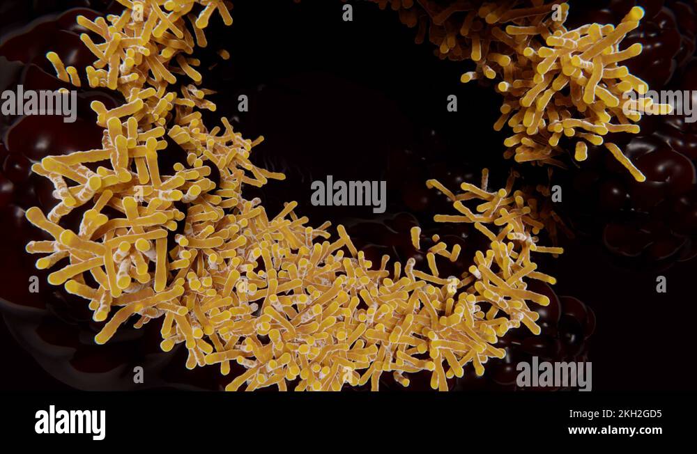Tubercle bacteria Stock Videos & Footage - HD and 4K Video Clips - Alamy