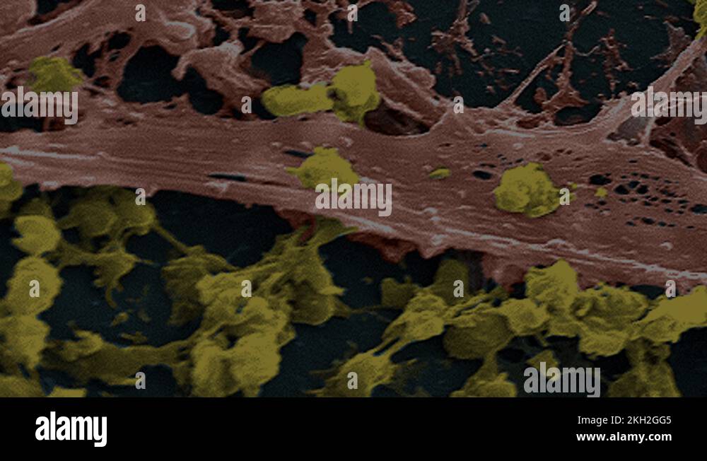 Staphylococcus aureus Bacteria, SEM Stock Video Footage - Alamy Staphylococcus aureus Bacteria, SEM Stock Video Footage - Alamy
