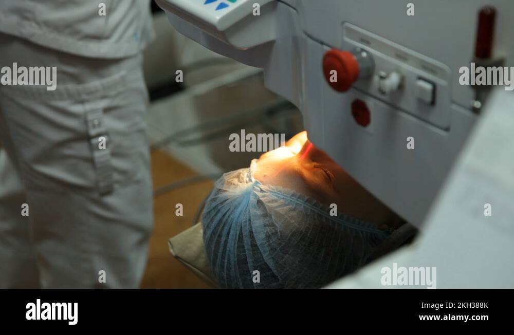 excimer laser vision correction. corneal cutting of the eye Stock Video ...