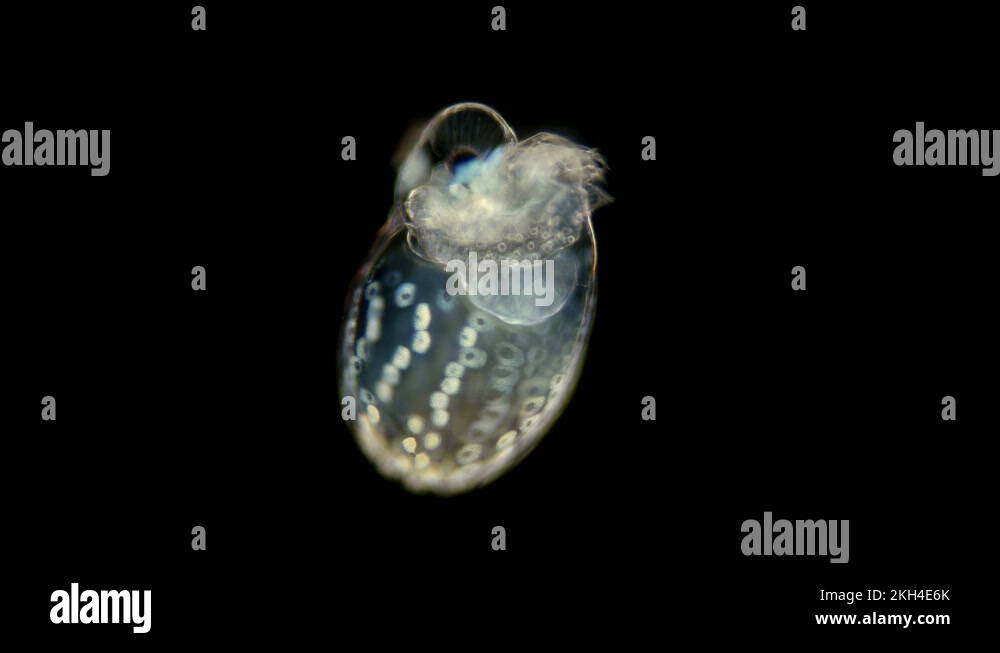 Black Sea plankton and zooplankton under a microscope, water flea or ...