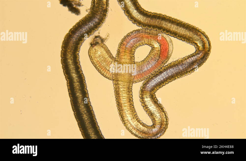 Roundworm microscope Stock Videos & Footage - HD and 4K Video Clips - Alamy