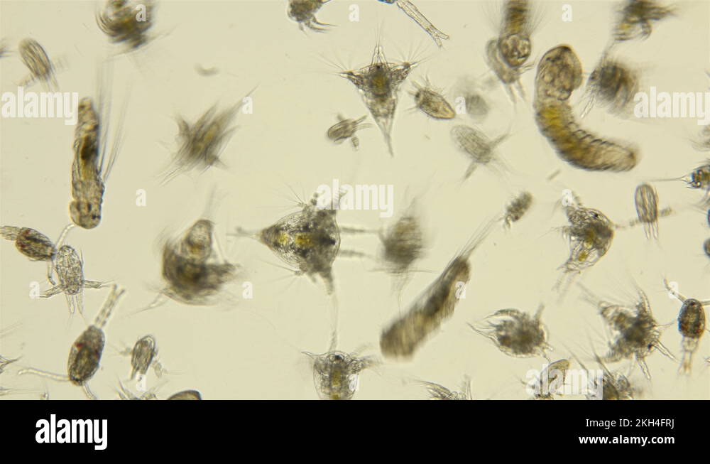 Black Sea plankton and zooplankton under a microscope, the diversity of ...