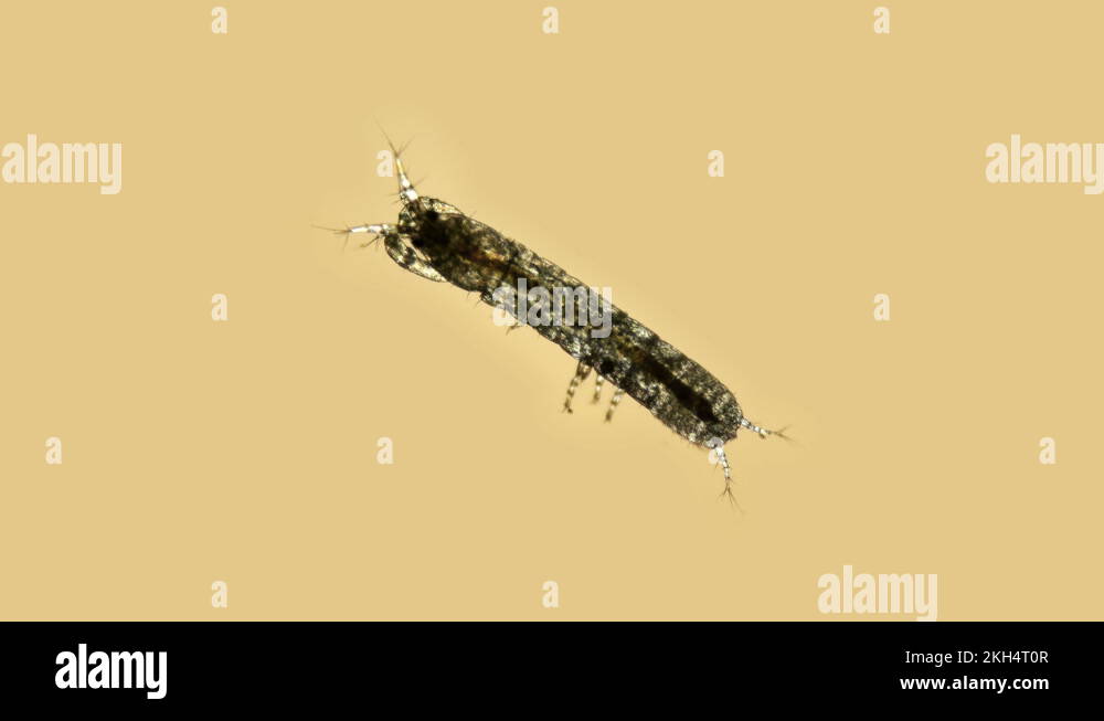 Black Sea plankton and zooplankton under a microscope, a small ...