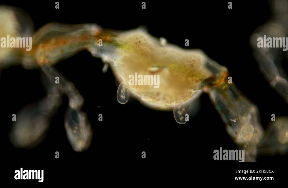 plankton isoplankton of the Black Sea under the microscope. Skeletal ...