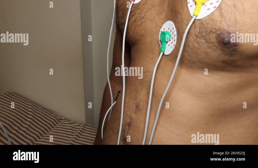 Cardiology - ECG Checkup in hospital Stock Video Footage - Alamy