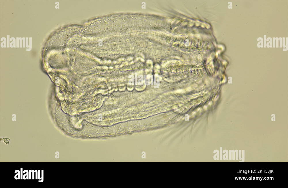 Black Sea plankton and zooplankton under a microscope,, the larva of ...