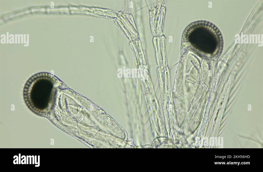 Black Sea plankton and zooplankton under a microscope, Mysid shrimp ...