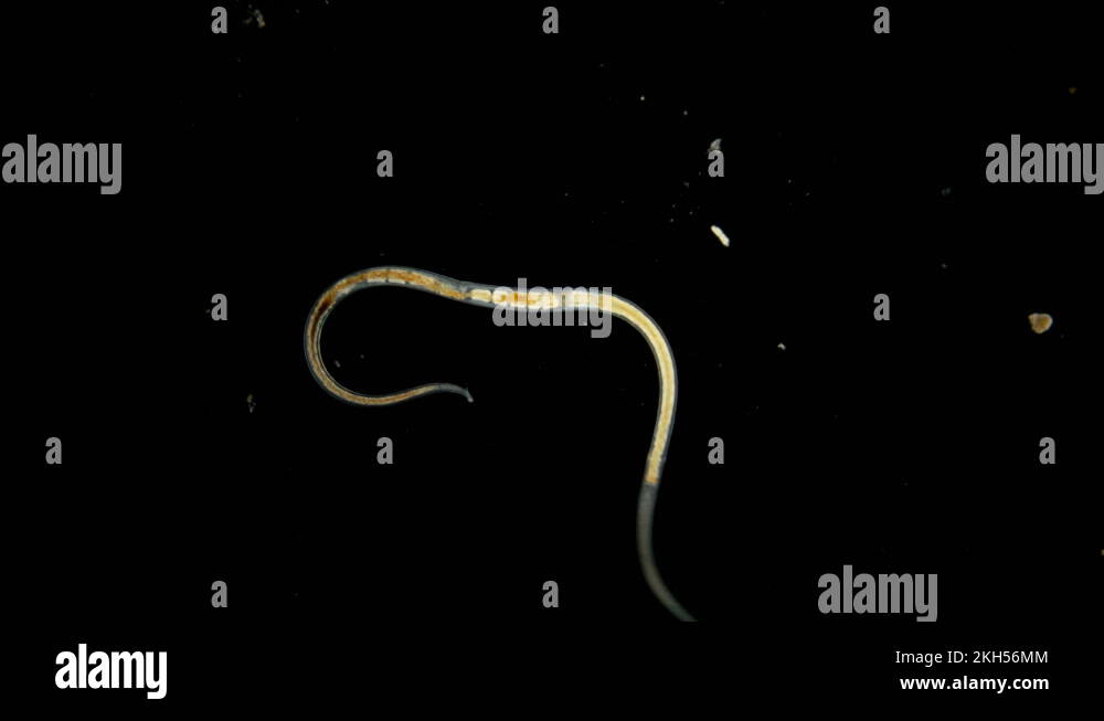 Sea plankton microscope Stock Videos & Footage - HD and 4K Video Clips - Alamy