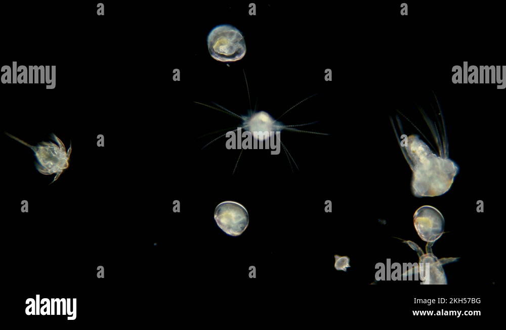 Black Sea plankton and zooplankton under a microscope, the diversity of ...