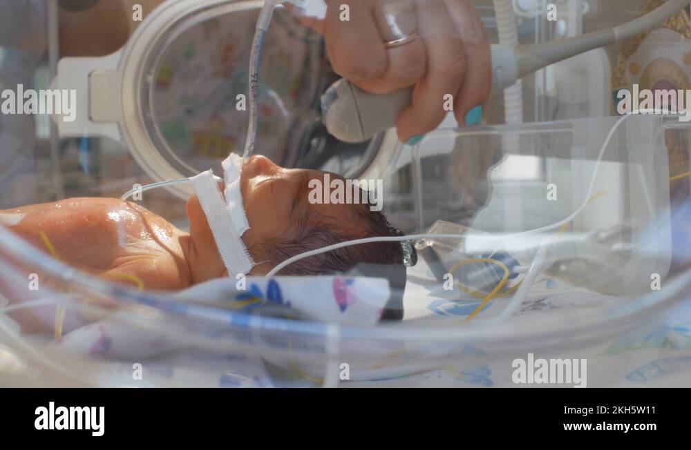 The doctor checks the ultrasound of the head in a premature newborn. 4k ...