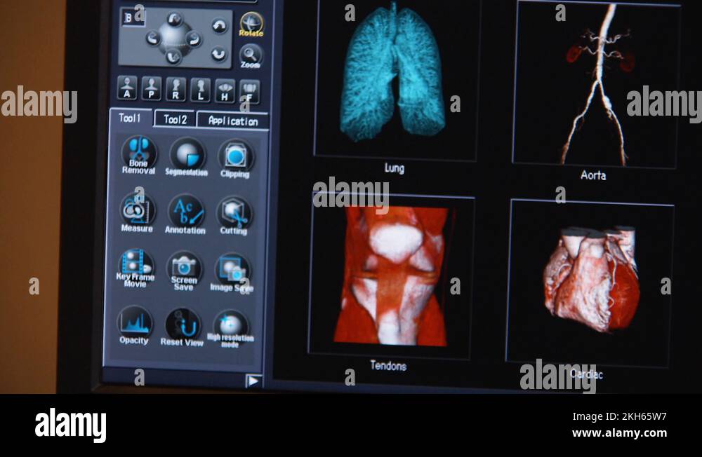CT scanner screen menu at hospital 3D view of parts of body A Stock ...