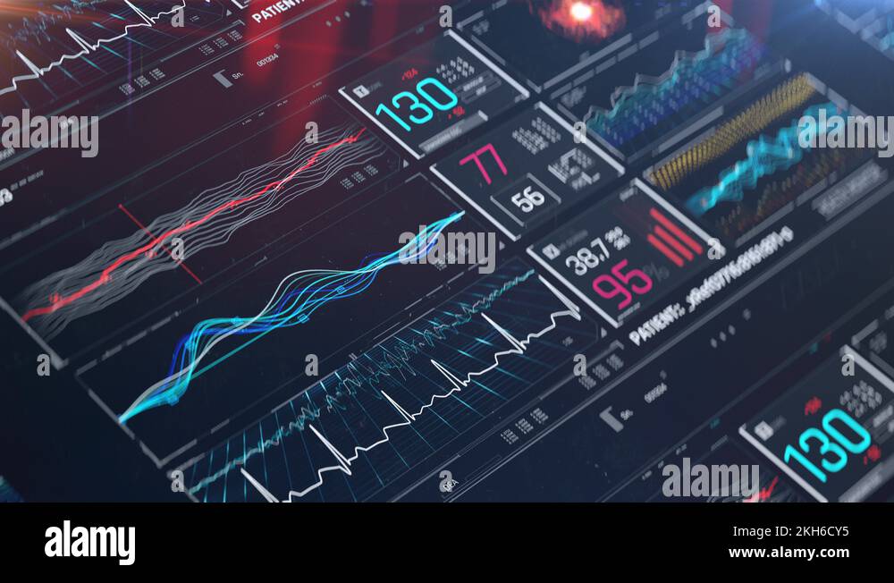 Cardiac arrest hospital Stock Videos & Footage - HD and 4K Video Clips ...