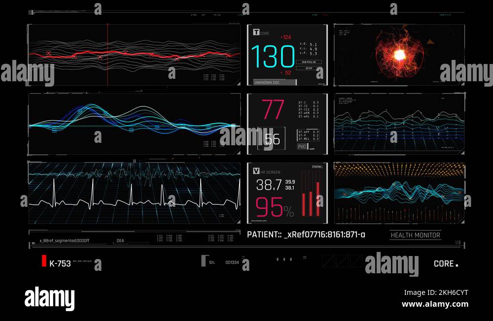 Heart failure heart monitor Stock Videos & Footage - HD and 4K Video ...