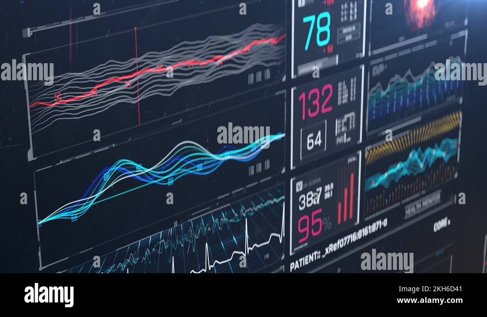 Medical ICU monitor with abnormal activity, arrhythmia, vital signs ...