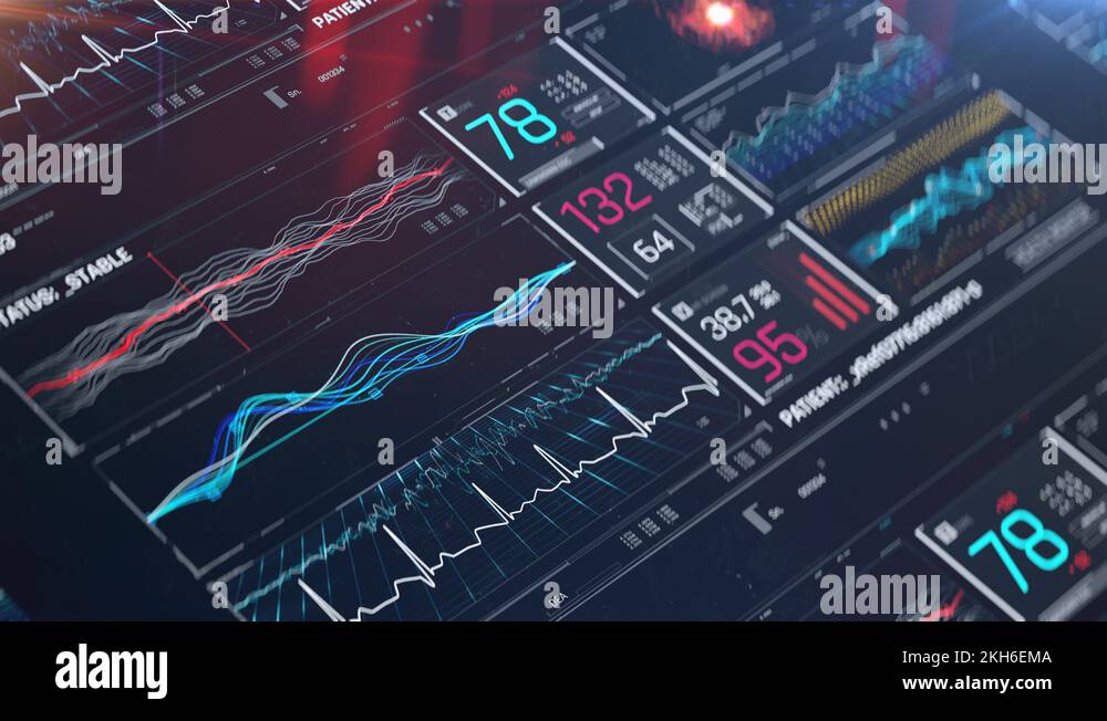 Patient in stable condition, intensive care health monitor showing ...