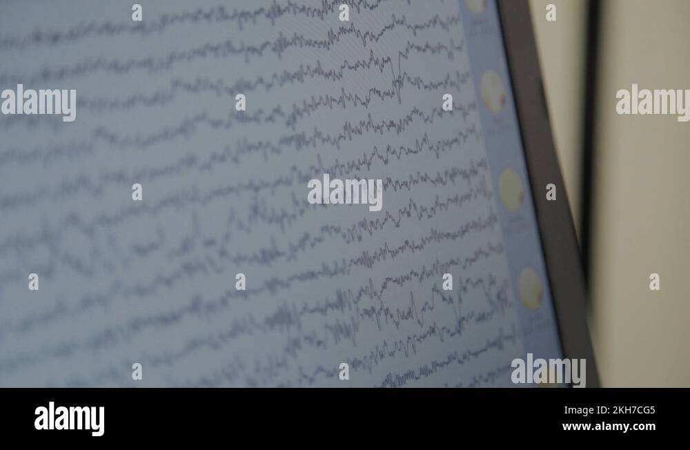Brain wave monitoring Stock Videos & Footage - HD and 4K Video Clips ...