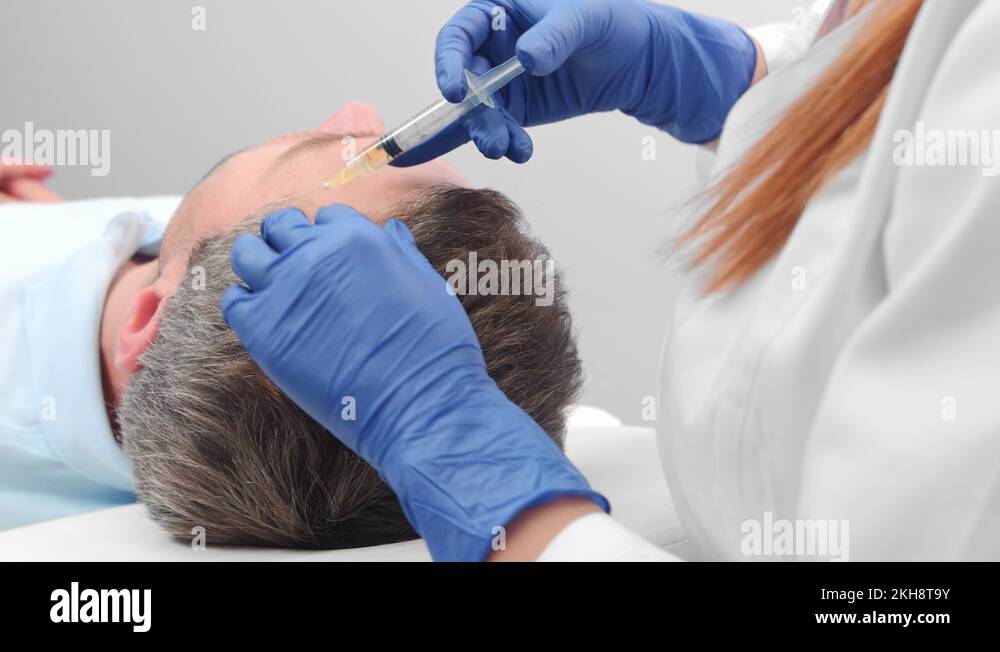 Hair loss injections Stock Videos & Footage - HD and 4K Video Clips - Alamy