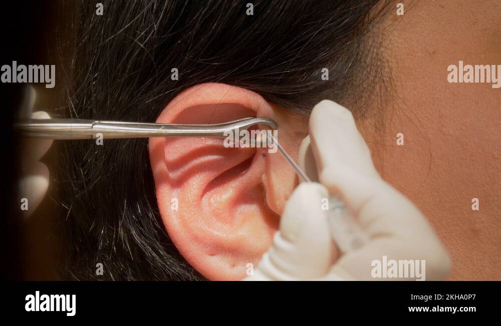 Body piercing procedure Stock Videos & Footage - HD and 4K Video Clips ...