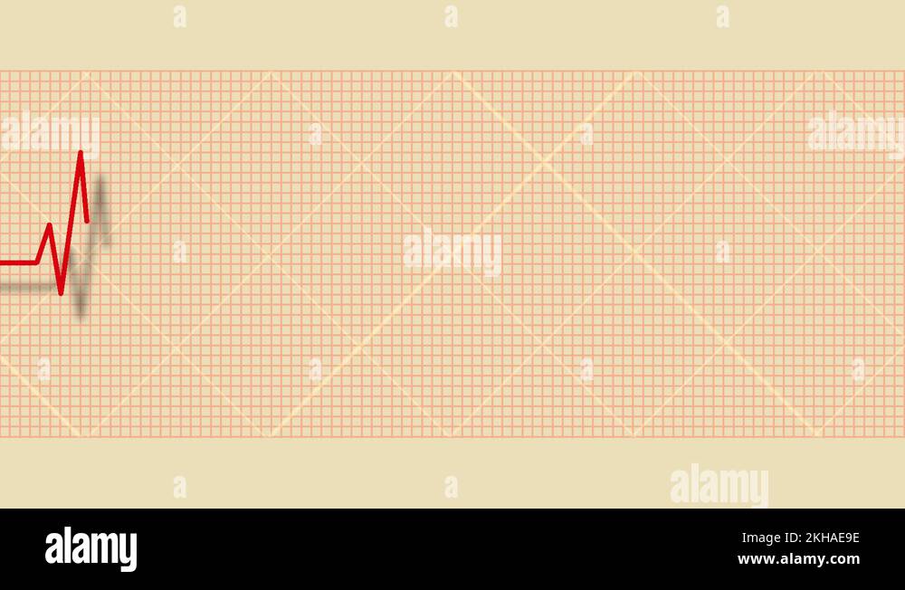 Electrocardiography The rhythm of a healthy heart. Red line heart rate ...