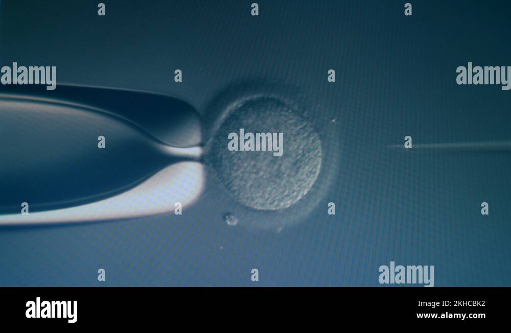 Fertilized human egg Stock Videos & Footage - HD and 4K Video Clips - Alamy