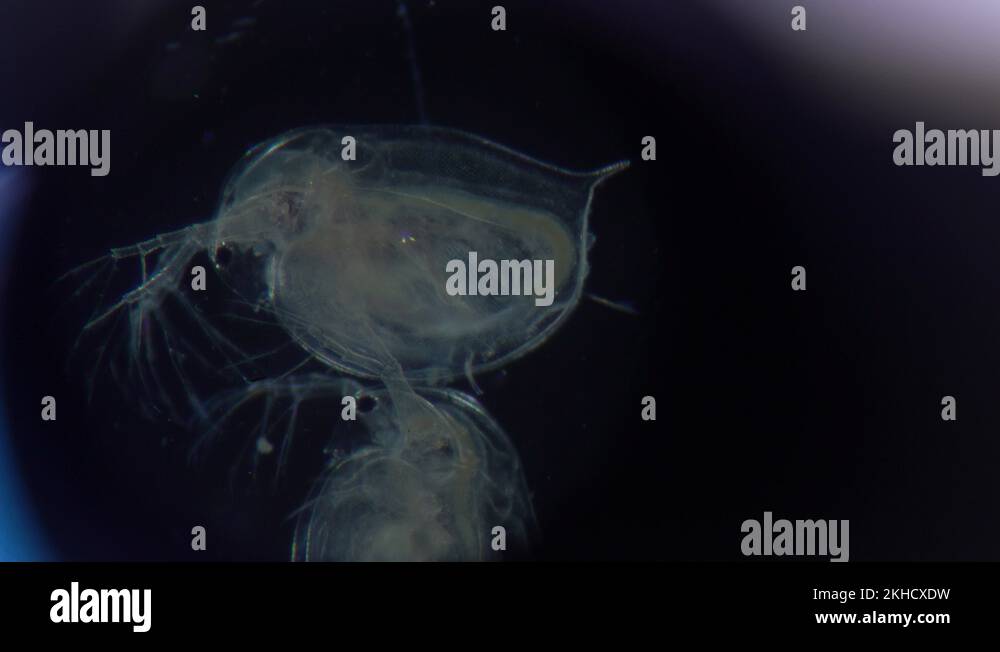 infusoria the shoe feeds by fingering the cilia under a microscope ...