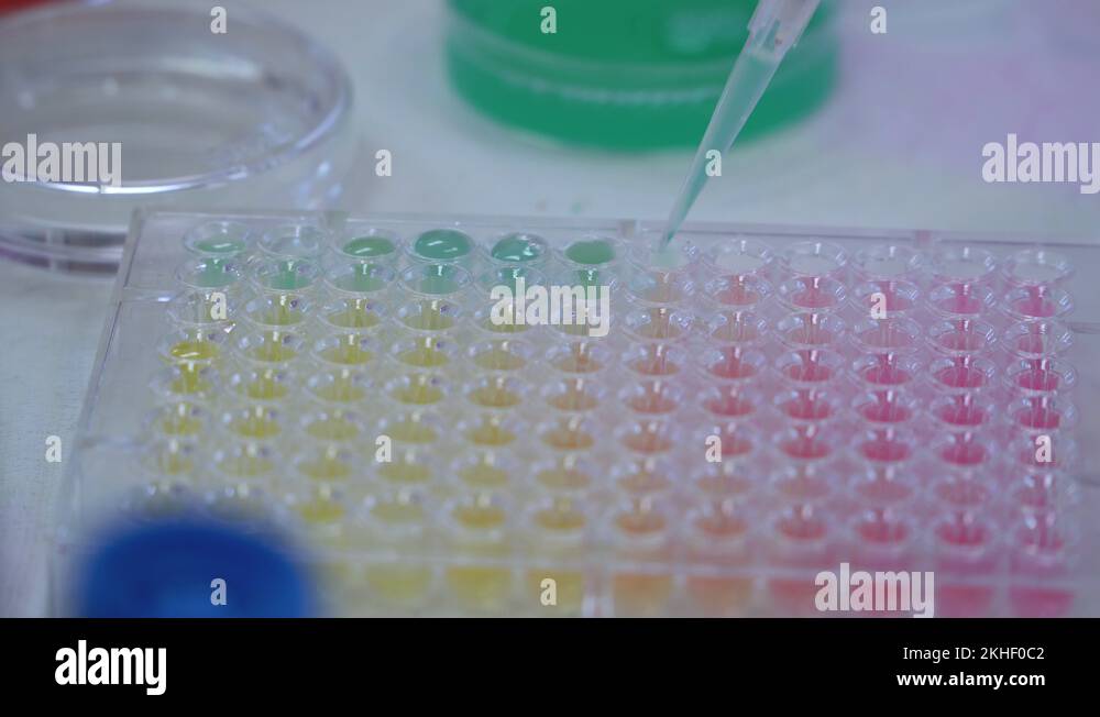 A pipette loads biological samples into a microplate for laboratory ...
