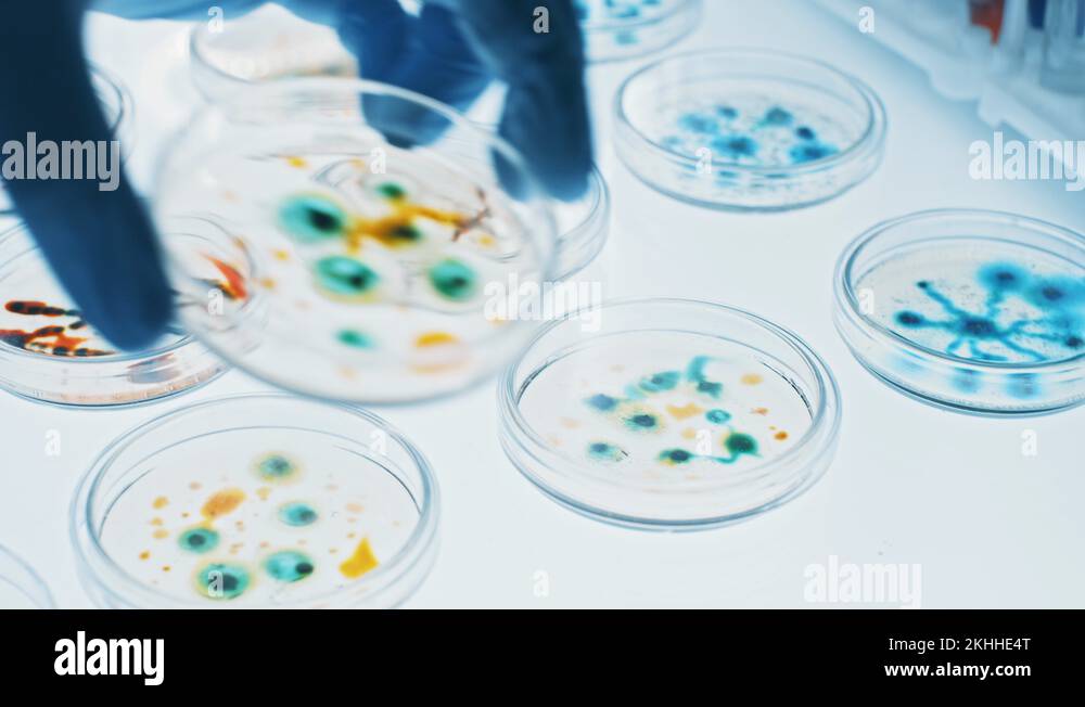 Microbiology Laboratory: Petri Dishes with Various Bacteria Samples ...