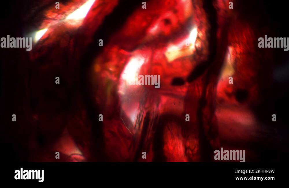 Biological background of red transparent worms in the light of a ...