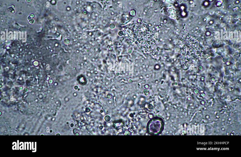 Movement of milk bacteria in milk leaven under a microscope Stock Video ...
