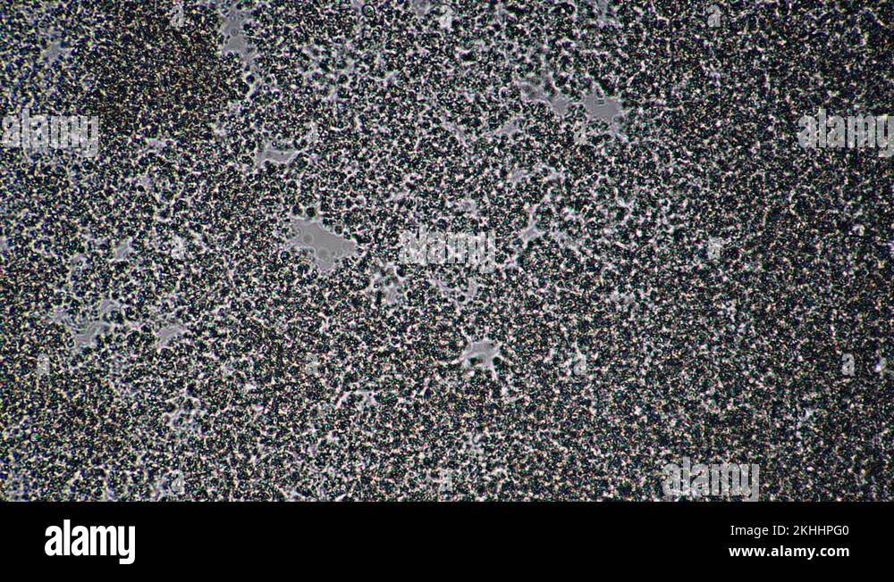 Microscope lactic acid bacteria Stock Videos & Footage - HD and 4K ...