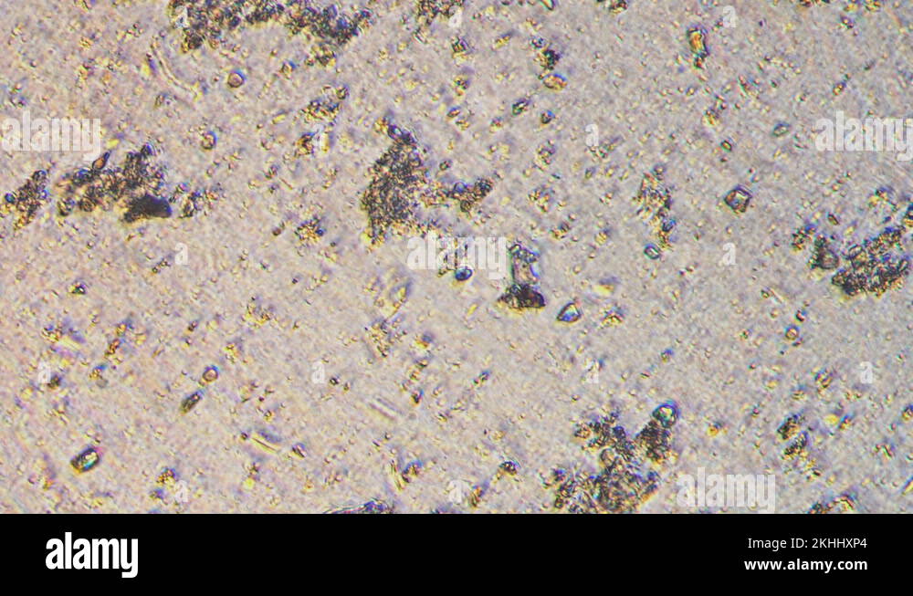 Microscopy of multiple colonies of protozoa and bacteria in the water ...