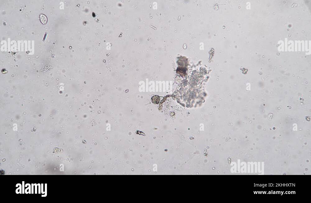 Protozoa bacteria Stock Videos & Footage - HD and 4K Video Clips - Alamy