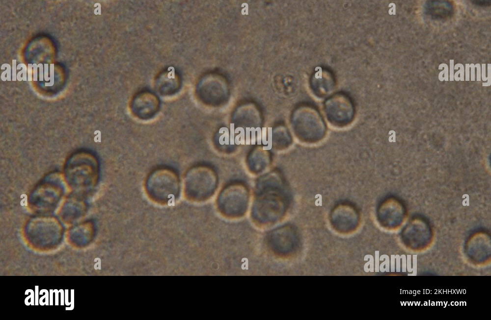 Microscopy of yeast cells (Saccharomyces cerevisiae). Magnification ...