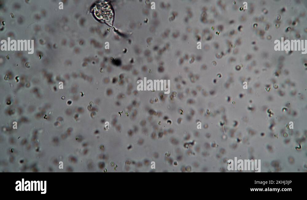 Observation under microscope Stock Videos & Footage - HD and 4K Video ...