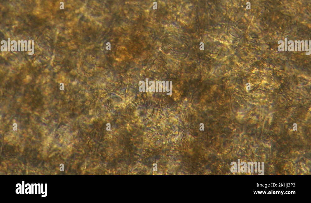 Microscopy of berry plant (grapes tissue). Magnification 300x with ...