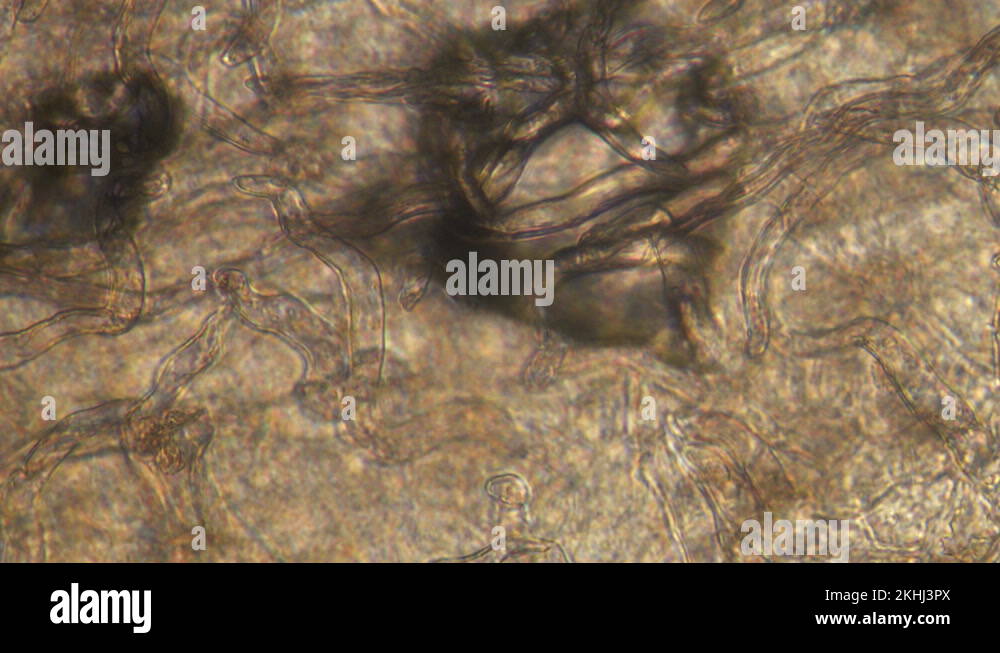 Microscopy of parasite worm nematode (Strongyloides stercoralis ...