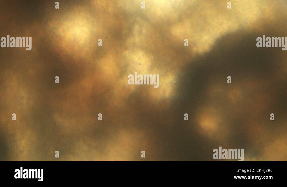 Microscopy of insect small fruit flies (Drosophila). Magnification 300x ...