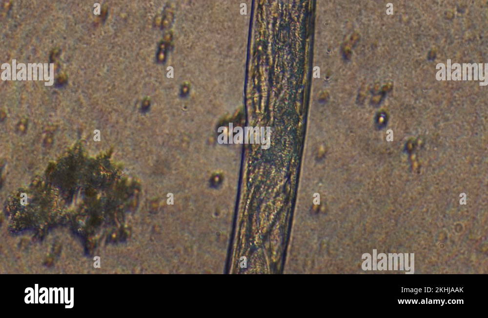 Microscopy Of Parasite Worm Nematode Strongyloides Stercoralis Closeup Moveme Stock Video