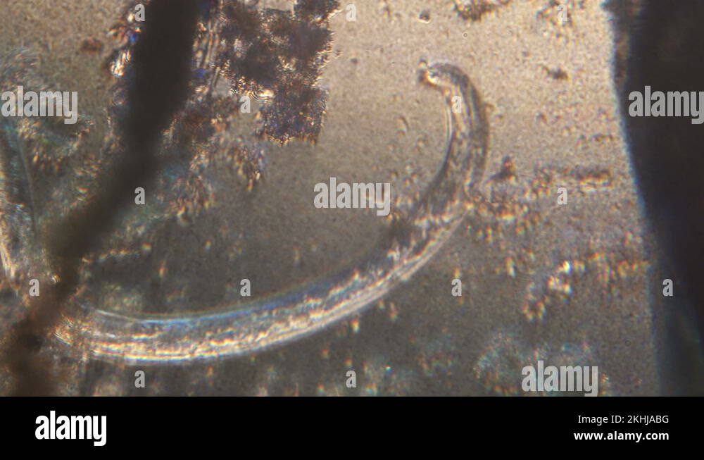 Microscopy of parasite worm nematode (Strongyloides stercoralis ...