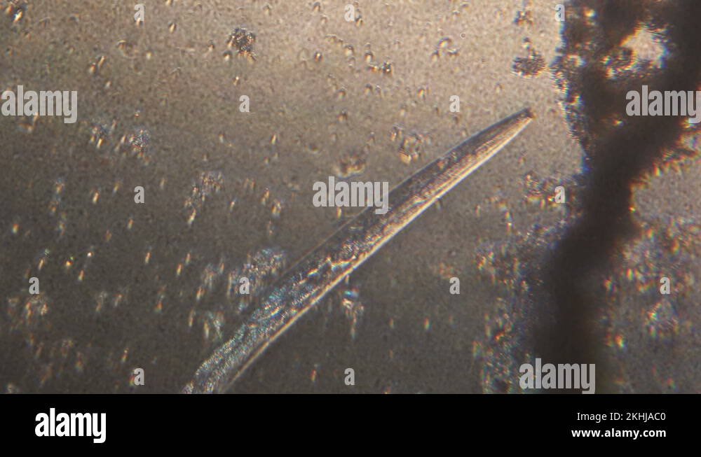 Microscopy of parasite worm nematode (Strongyloides stercoralis). Movement of ac Stock Video ...
