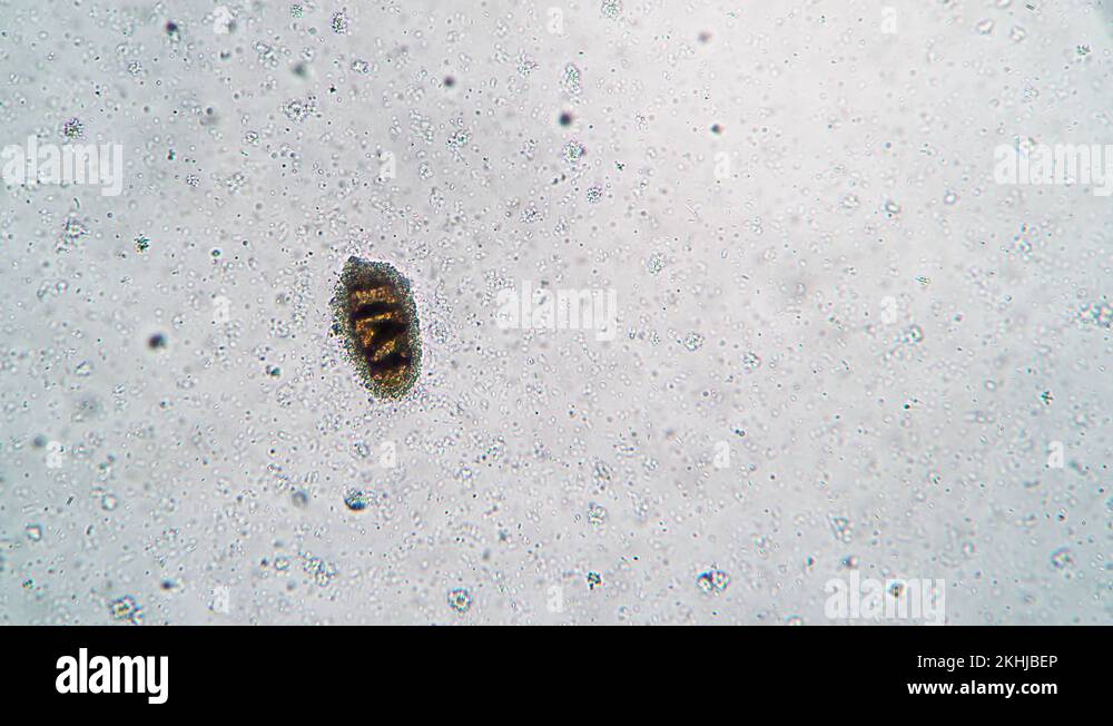 A large colony of micro-organisms and scavengers eat the dead body ...