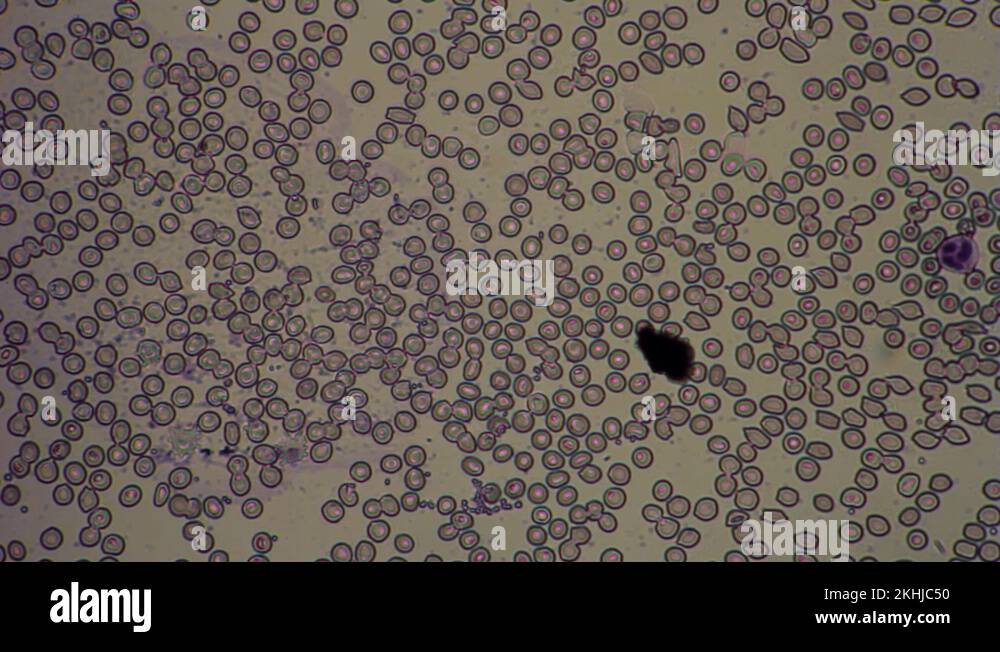 White blood cells in a blood smear Stock Videos & Footage - HD and 4K ...